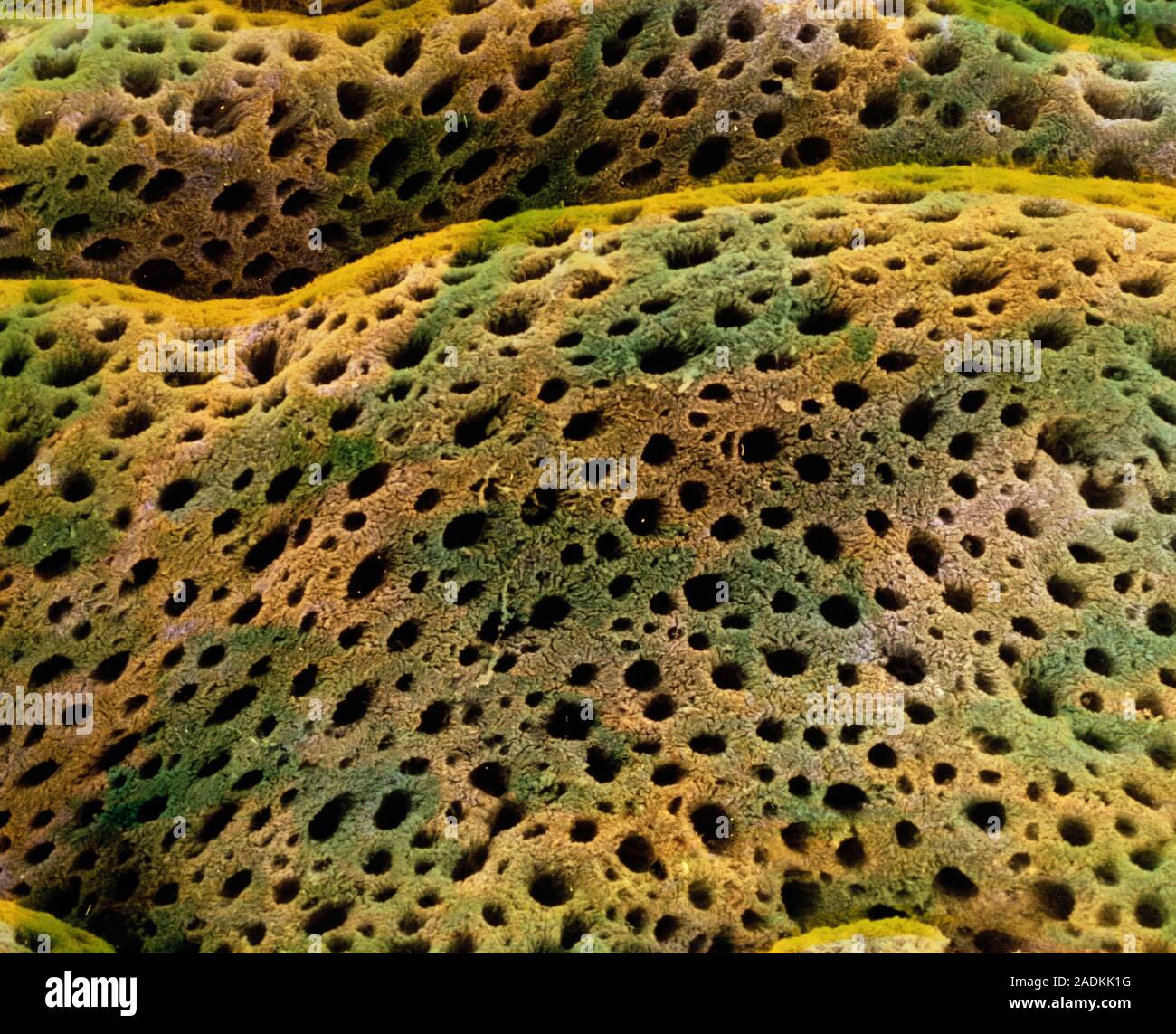 Uterus at oestrus. Coloured Scanning Electron Micrograph (SEM) of the ...