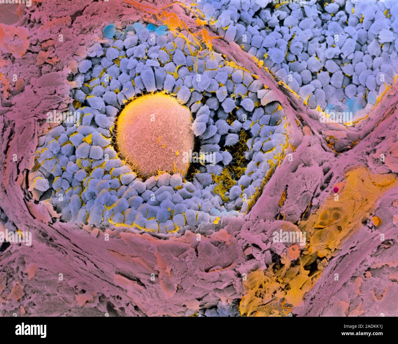Secondary follicles in ovary. Coloured Scanning Electron Micrograph ...