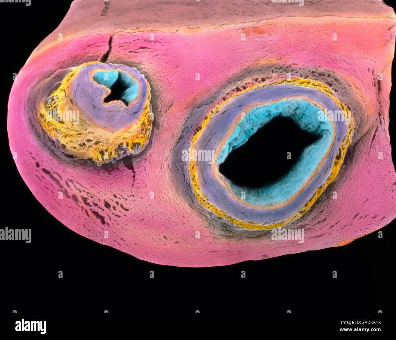 Umbilical cord. Coloured Scanning Electron Micro- graph (SEM) of a ...