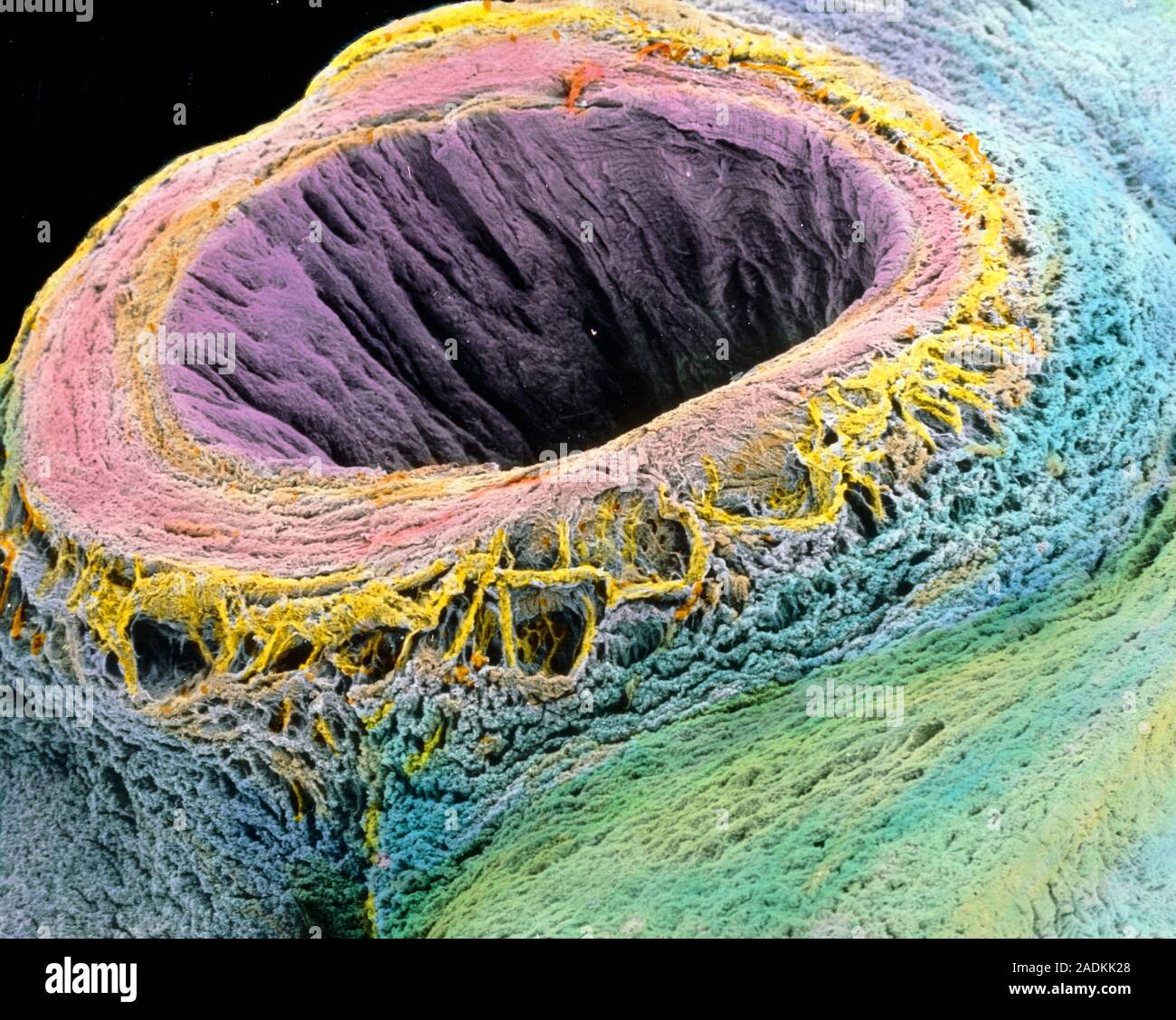 Umbilical cord. Coloured Scanning Electron Micro- graph (SEM) of a ...