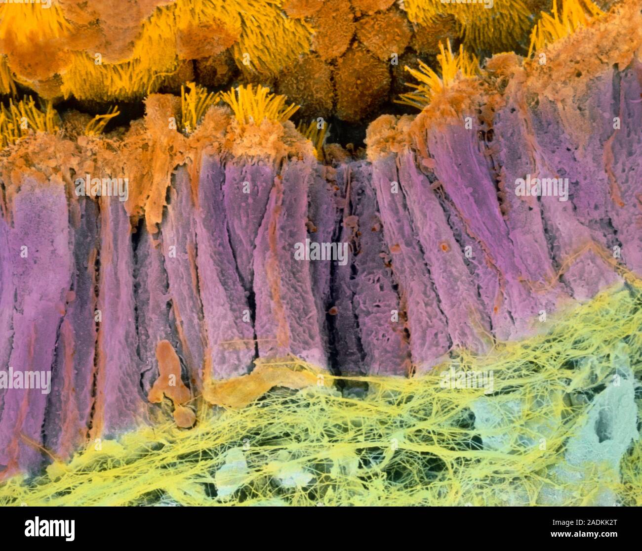 Fallopian tube. Coloured Scanning Electron Micro- graph (SEM) of ...