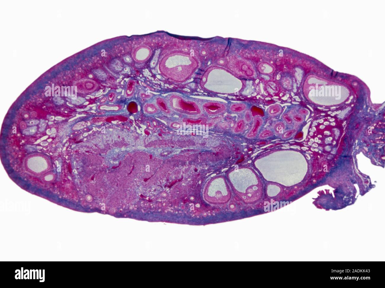 Ovary. Light micrograph of a transverse section through a healthy ovary ...