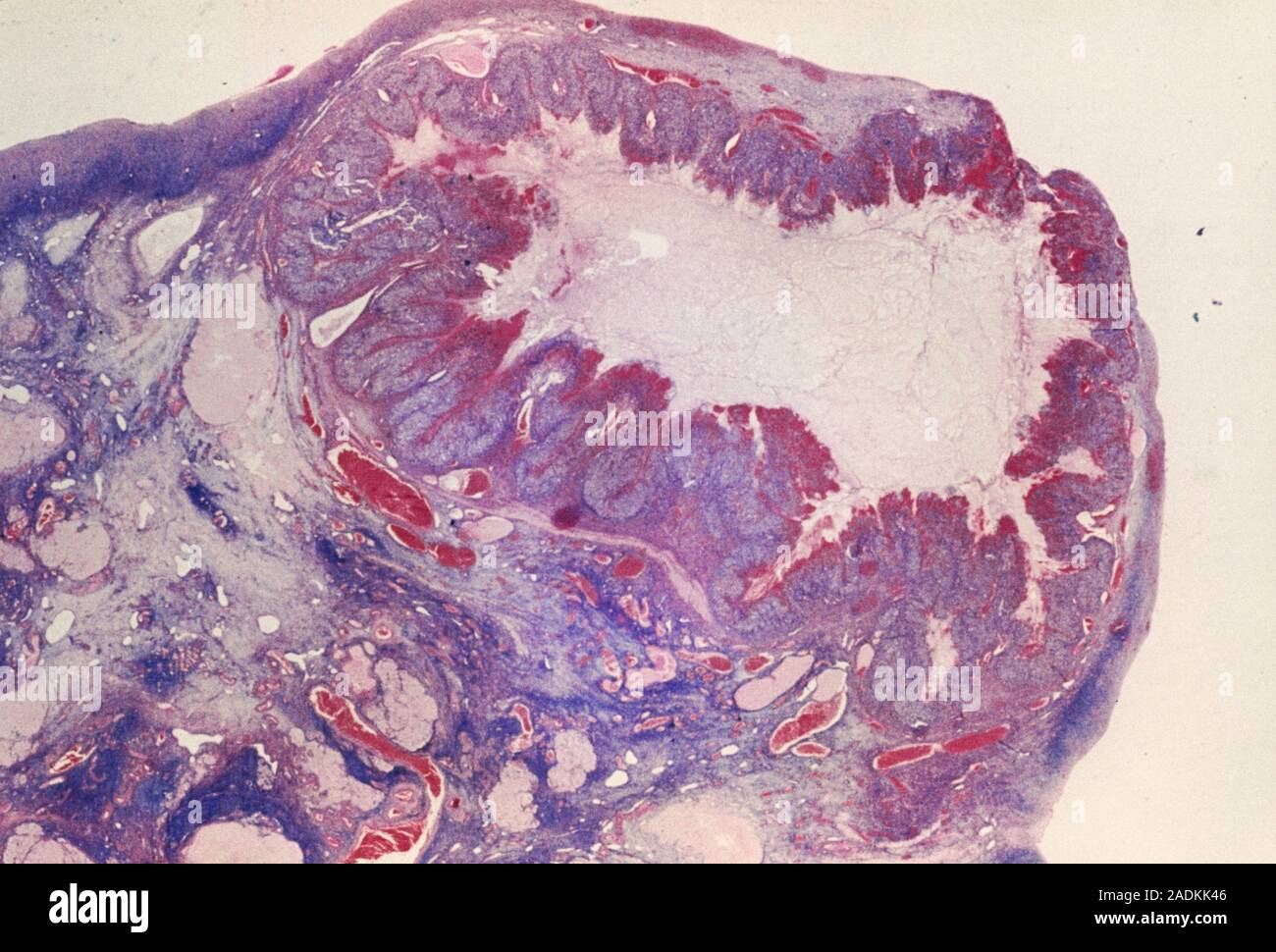 Corpus luteum. Light micrograph of a developing corpus luteum in a ...