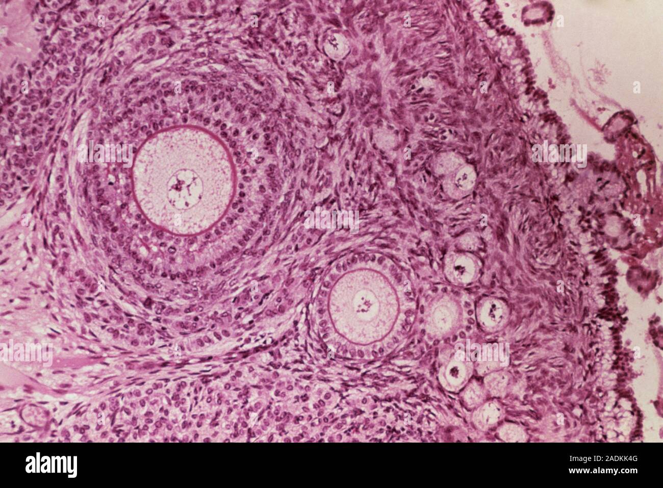 Egg follicles of the ovary. Light micrograph of a longitudinal section ...