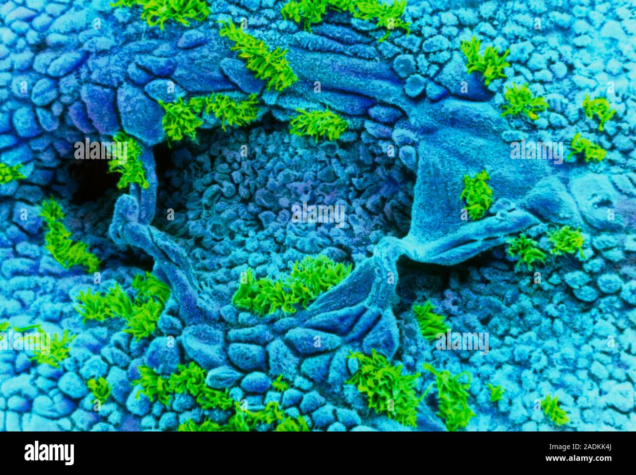 Uterus (early proliferation). Coloured scanning electron micrograph ...
