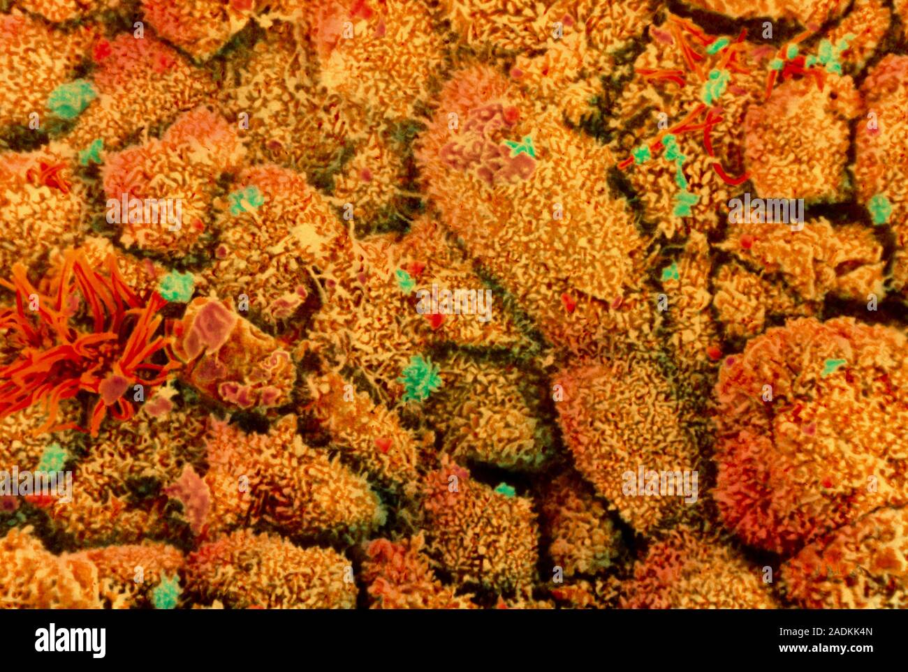 Uterus (late-secretory stage). Coloured scanning electron micrograph ...