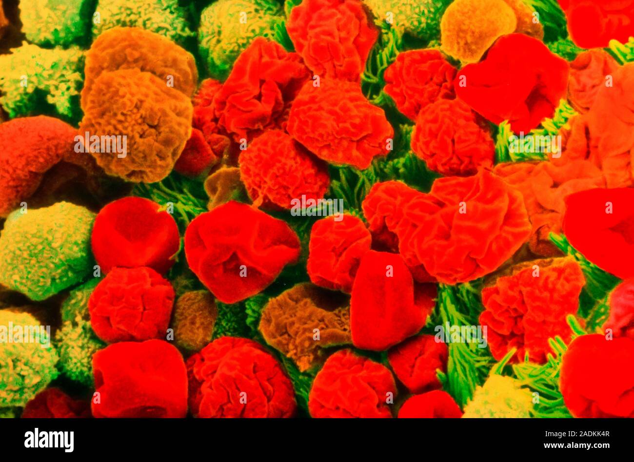 Uterus (receptive stage). Coloured scanning electron micrograph (SEM ...