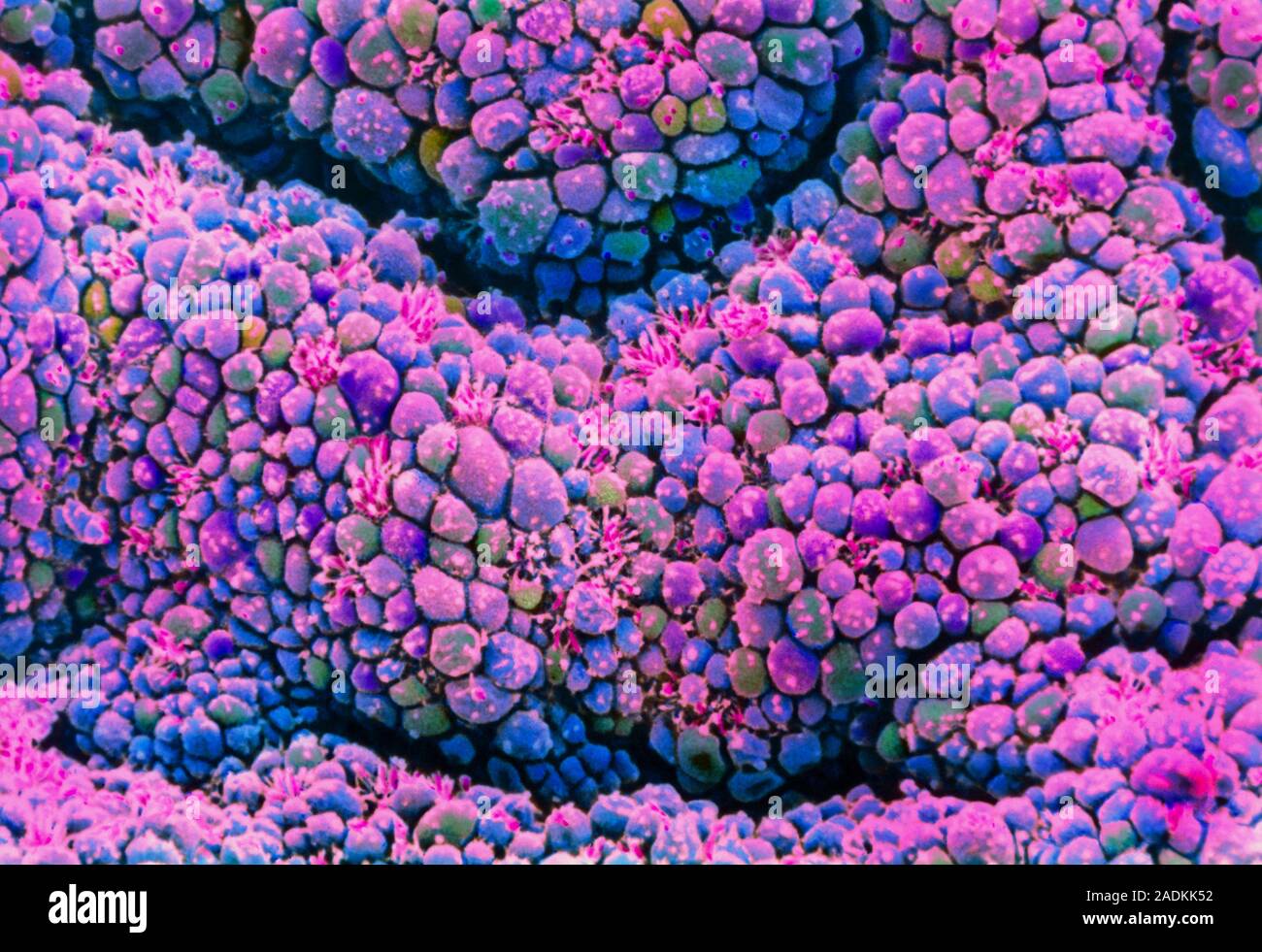 Uterus (receptive stage). Coloured scanning electron micrograph (SEM ...