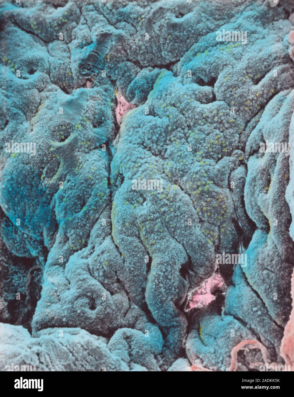 Uterus lining. Coloured scanning electron micro- graph (SEM) of the ...