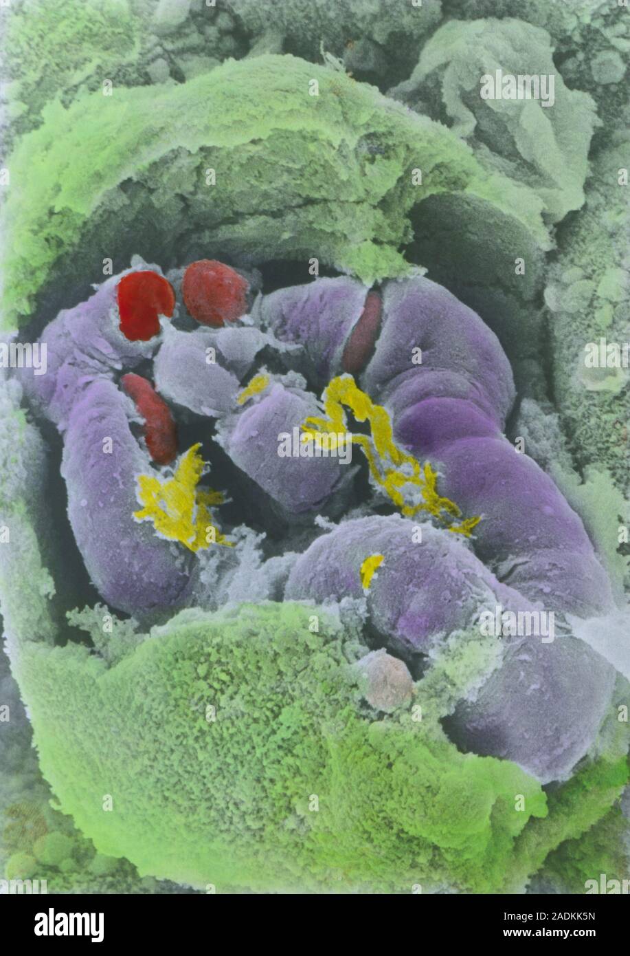 Placenta. Coloured scanning electron micrograph (SEM) of blood vessels ...