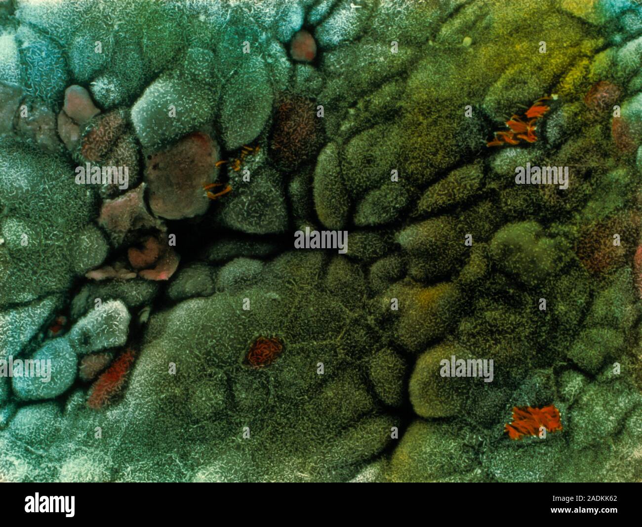 Post-menopausal uterus. Coloured scanning electron micrograph (SEM) of ...