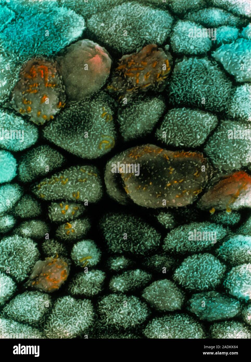 Post-menopausal uterus. Coloured scanning electron micrograph (SEM) of ...