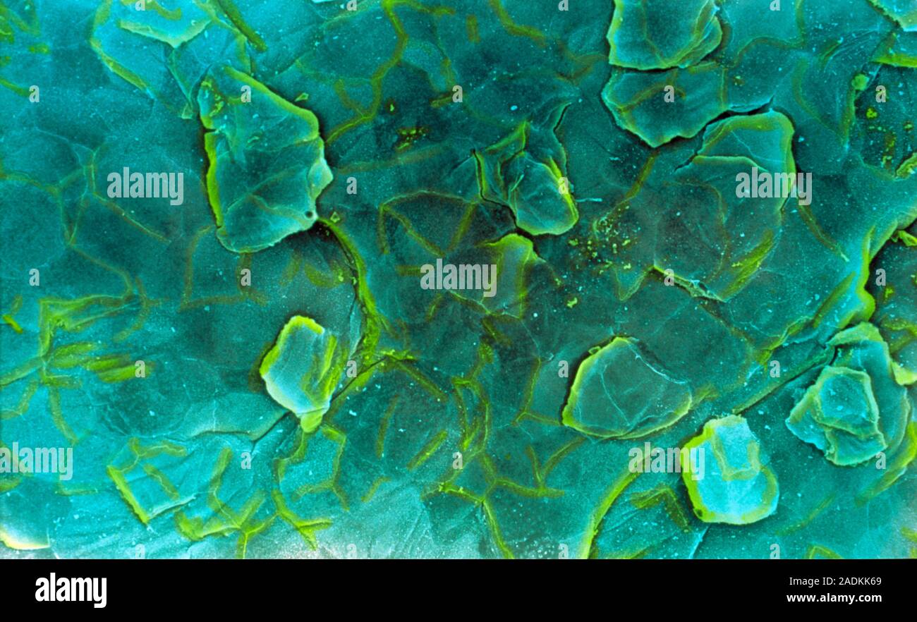 Cervix epithelium. Coloured scanning electron mic- rograph (SEM) of ...