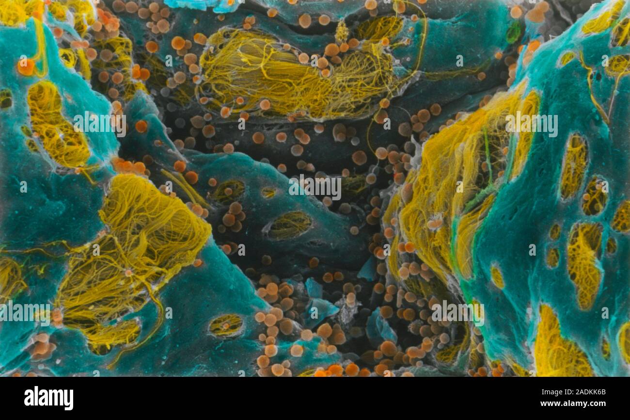 Menopausal fallopian tube. Coloured scanning electron micrograph (SEM ...