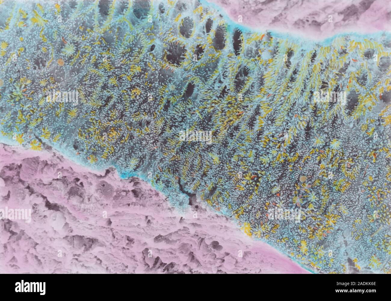 Menopausal uterine gland. Coloured scanning elect- ron micrograph (SEM ...