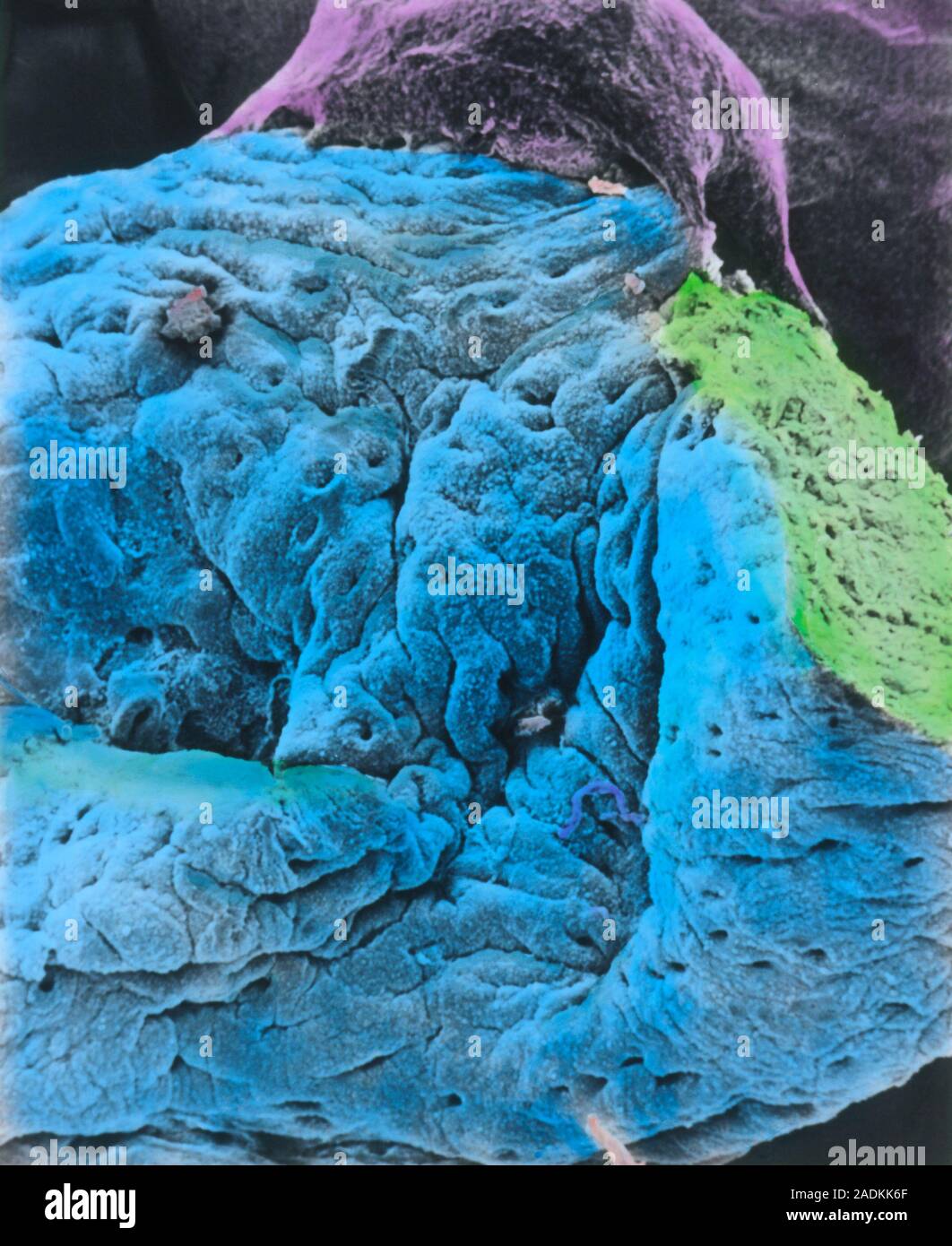 Uterus lining. Coloured scanning electron micro- graph (SEM) of the ...