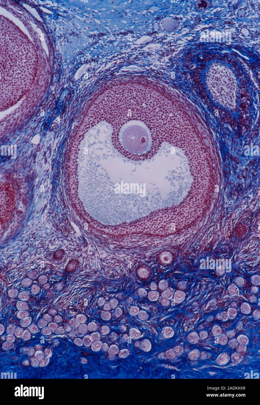Maturing follicle. Light micrograph of a sectioned ovary showing a ...