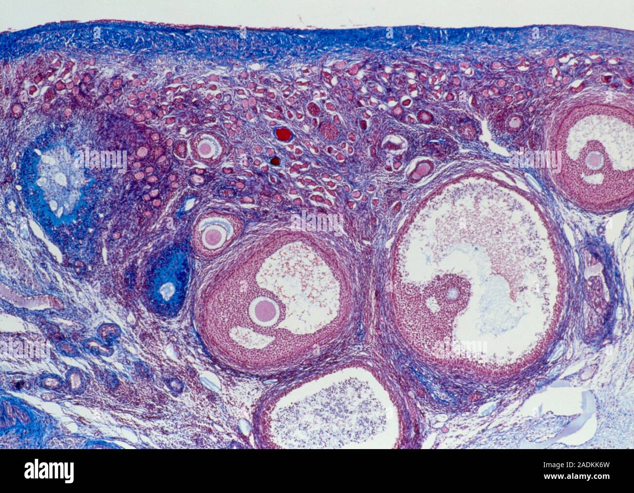 Maturing follicles. Light micrograph of a sectioned ovary showing ...