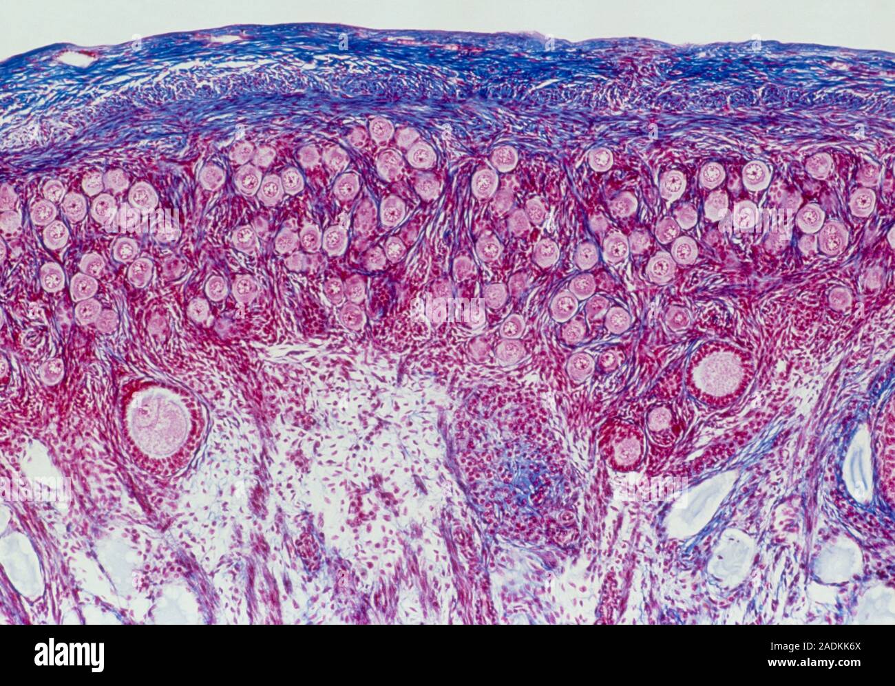 Ovarian follicles. Light micrograph of a sectioned ovary, showing the ...