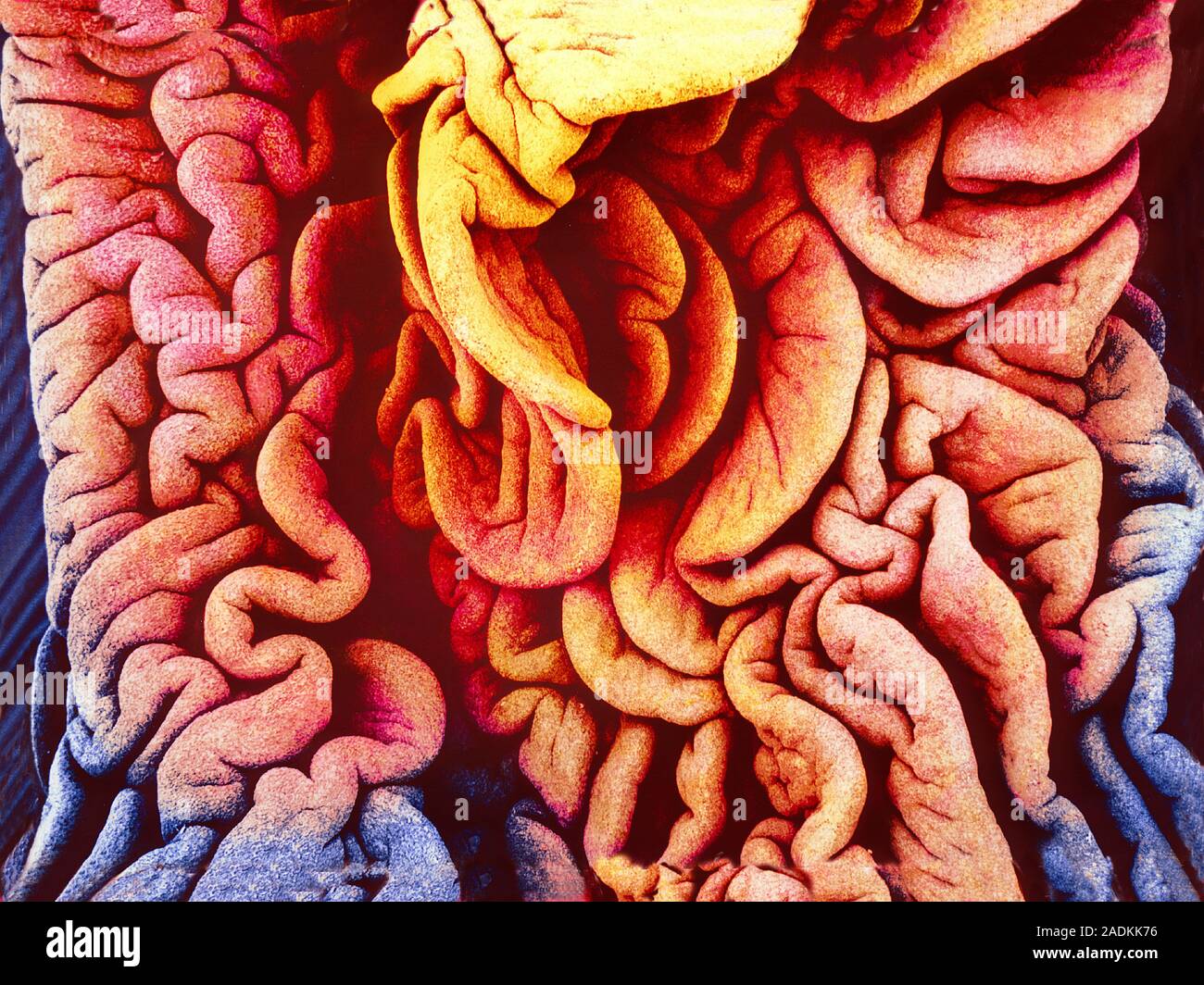 Fallopian tube. Coloured scanning electron micrograph (SEM) of a ...