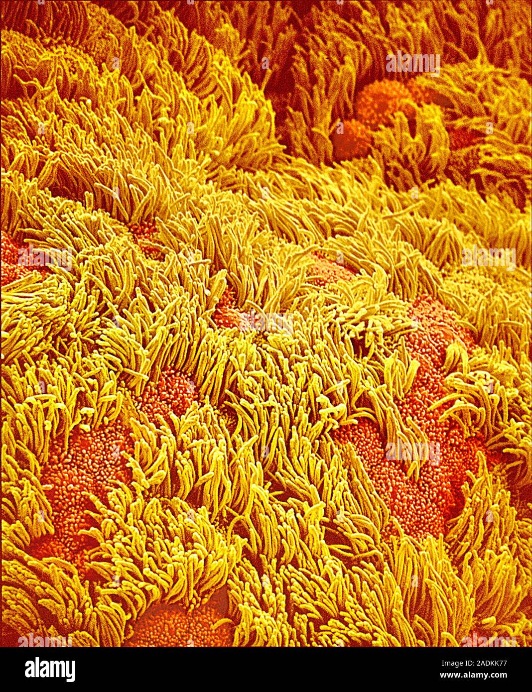 Fallopian tube. Coloured scanning electron micrograph (SEM) of the ...