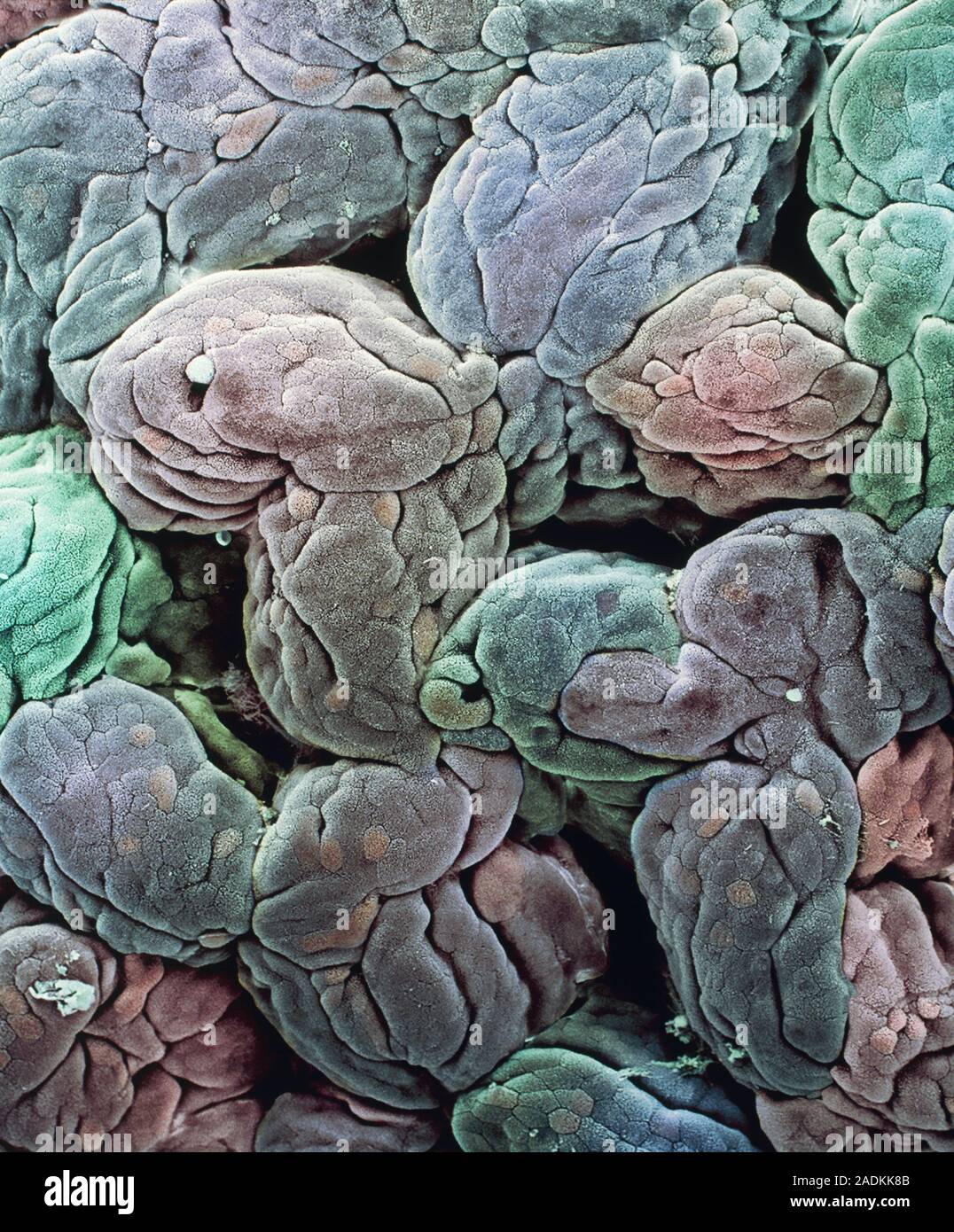Uterine lining. Coloured scanning electron micrograph (SEM) of the ...