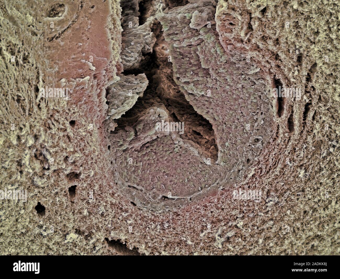 Fallopian tube. Coloured scanning electron micrograph (SEM) of a freeze-fractured section ...