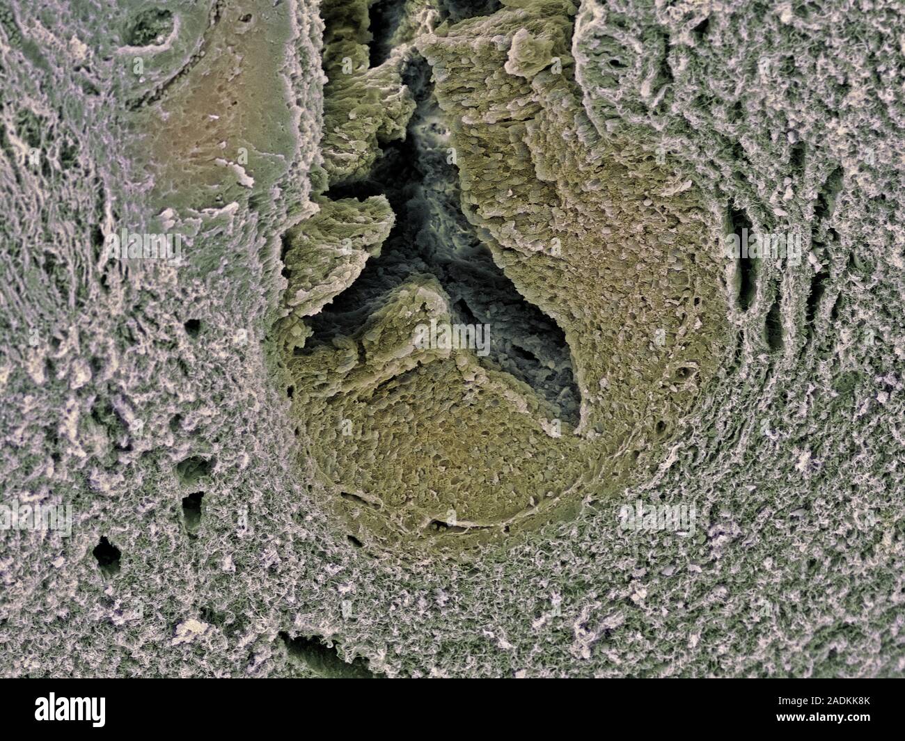 Fallopian tube. Coloured scanning electron micrograph (SEM) of a freeze ...