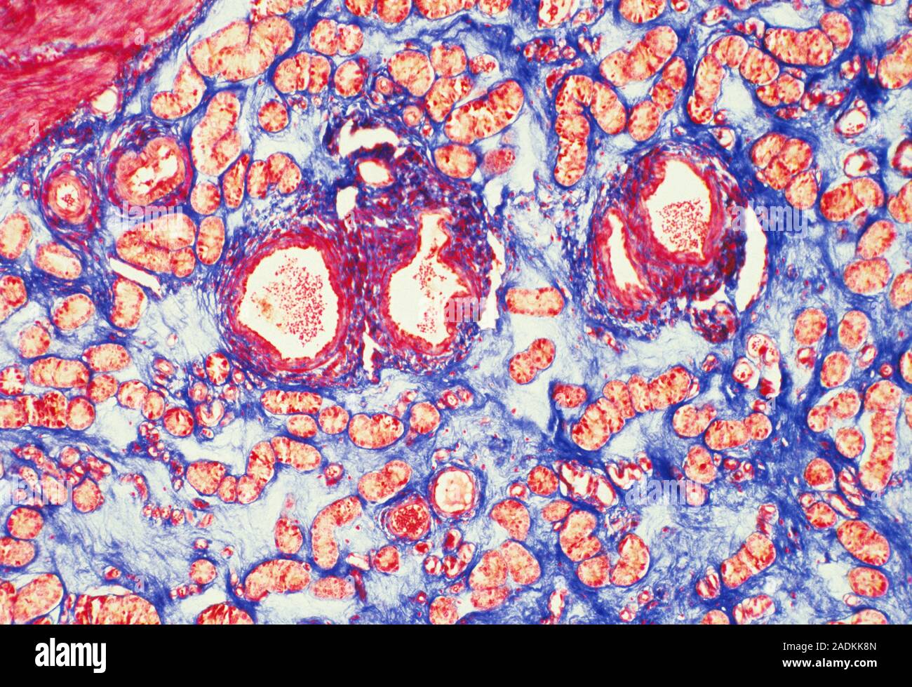 Uterus lining. Light micrograph of a section through the surface lining ...