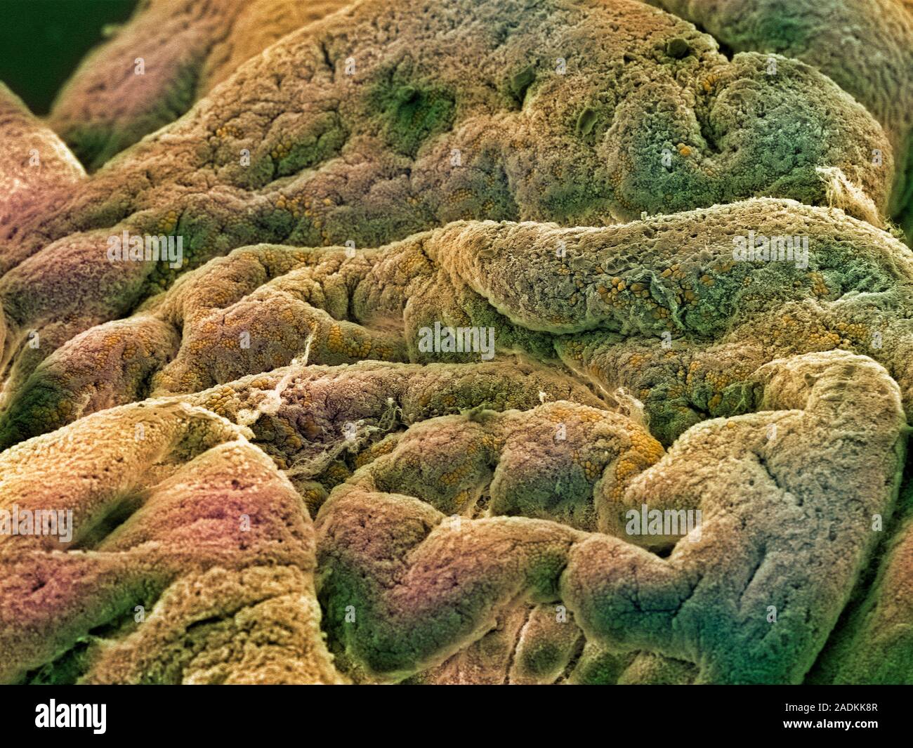 Fallopian tube. Coloured scanning electron micrograph (SEM) of the ...