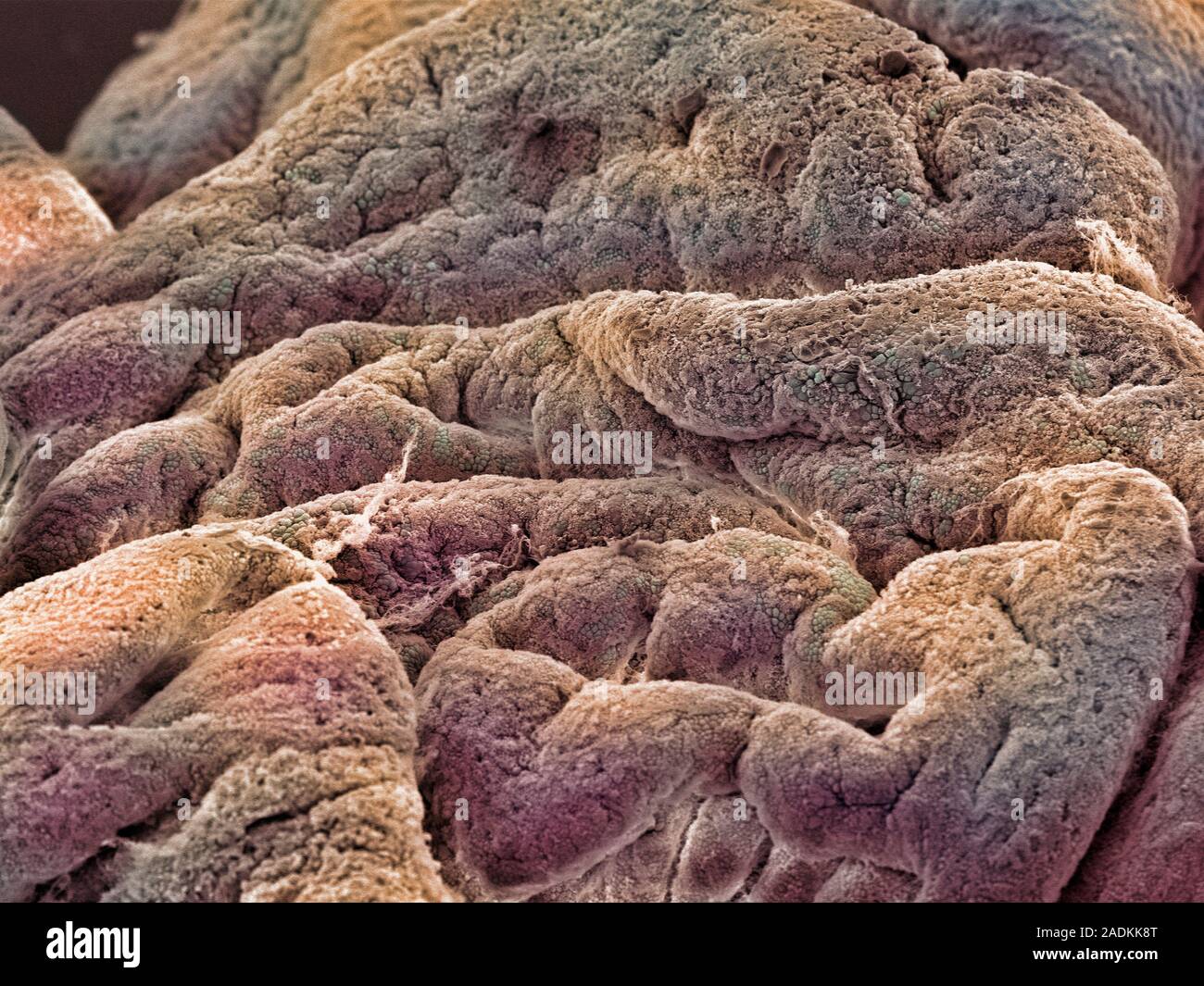 Fallopian tube. Coloured scanning electron micrograph (SEM) of the ...