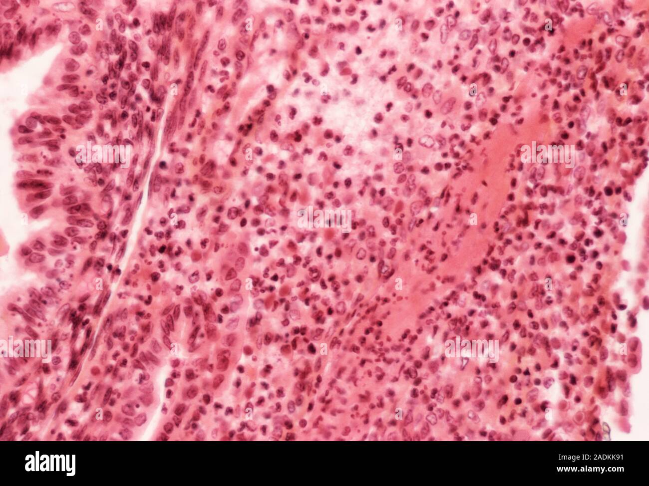 Histology Of The Human Endometrium During The Normal Cycle Ovary And