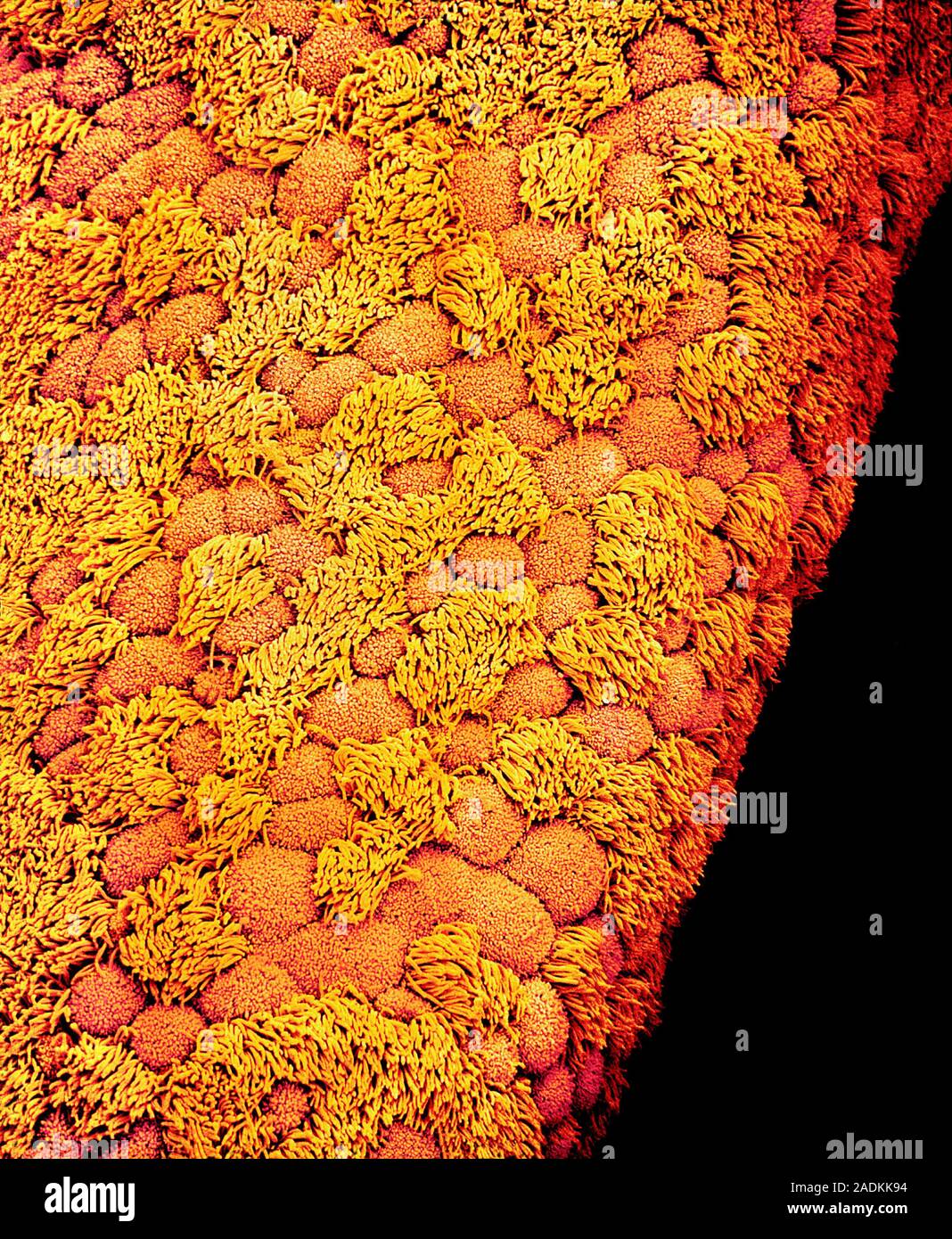 Fallopian tube. Coloured scanning electron micrograph (SEM) of the ...