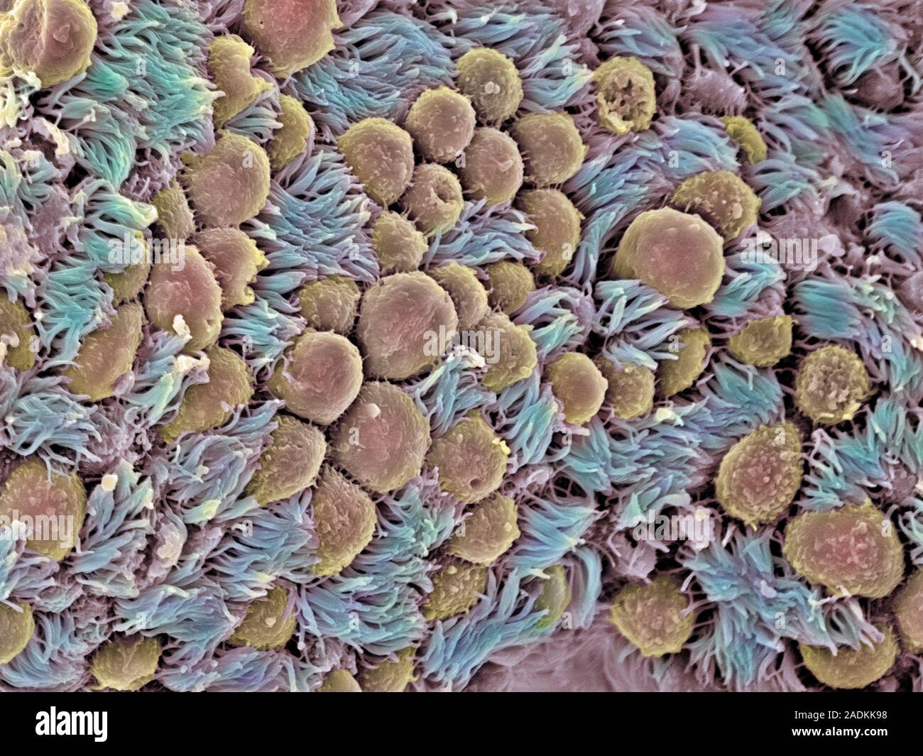 Fallopian tube. Coloured scanning electron micrograph (SEM) of the ...