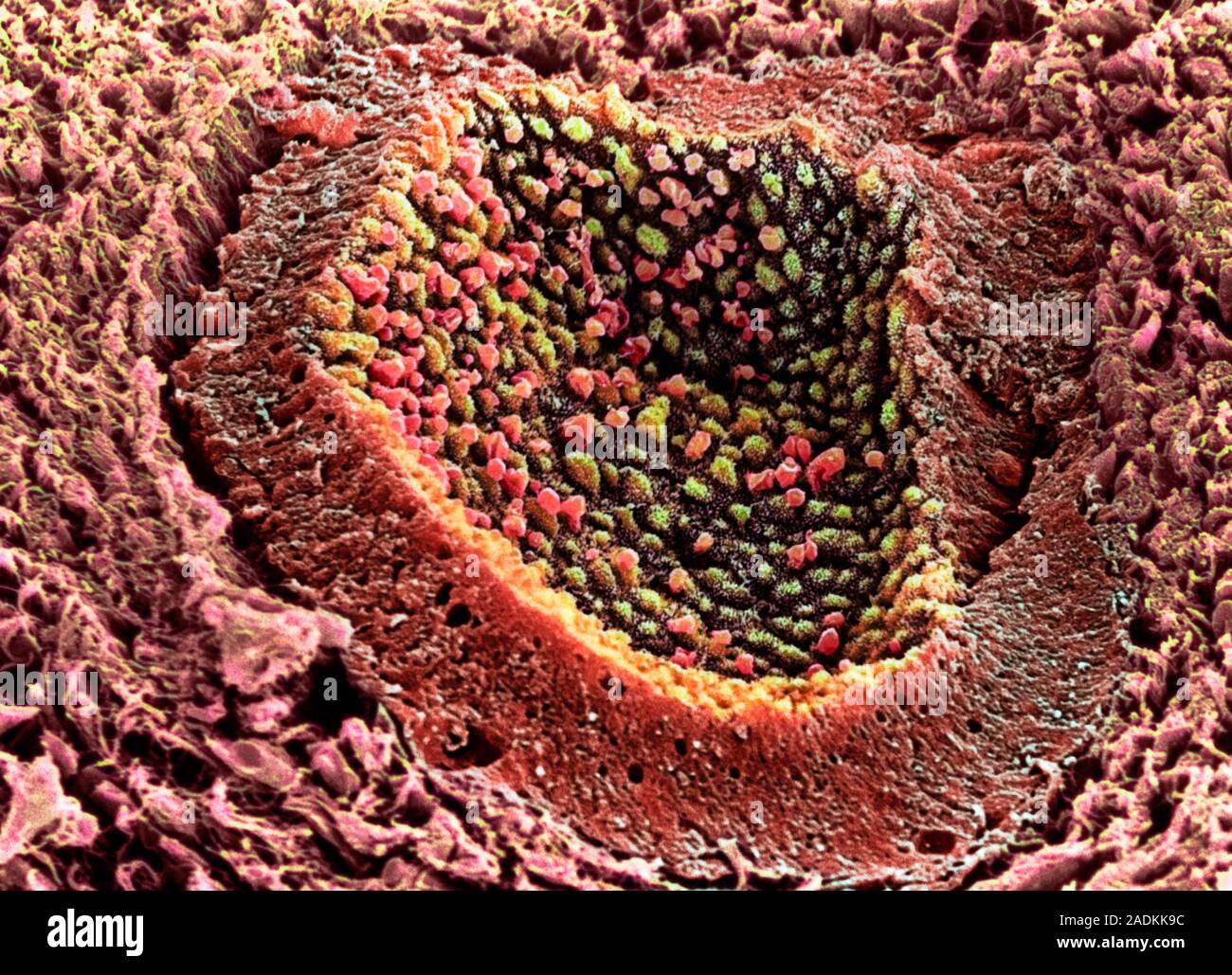 Uterine gland. Coloured scanning electron micrograph (SEM) of a section ...