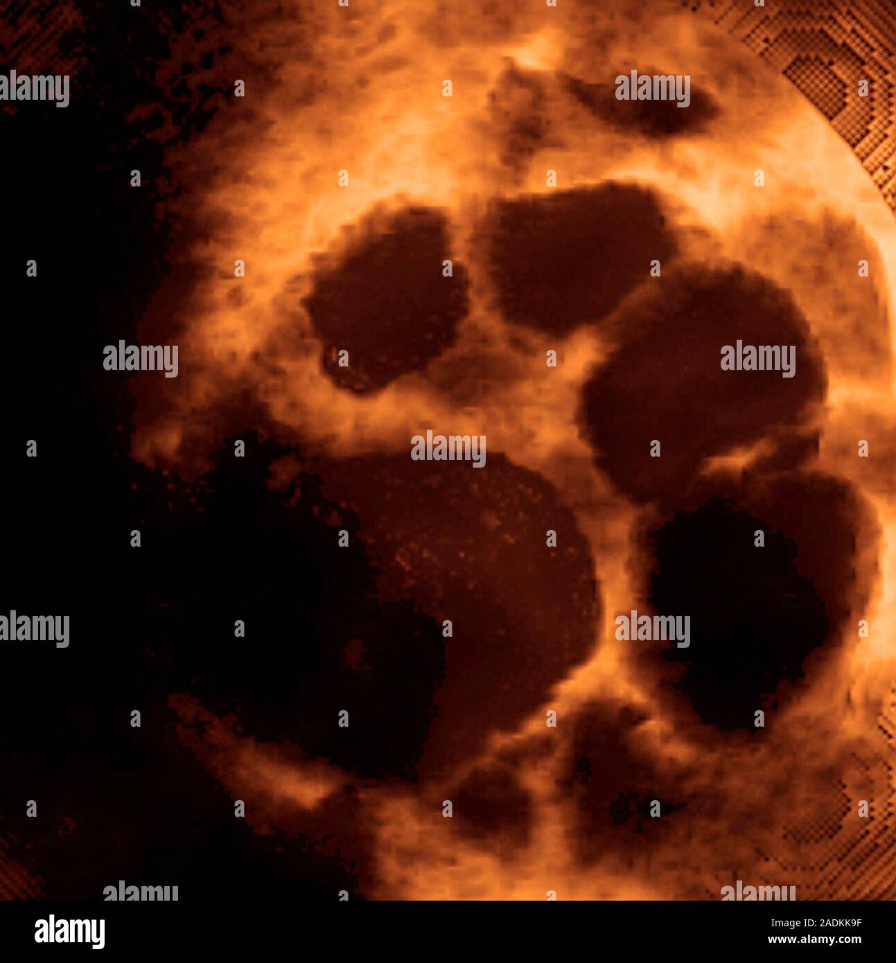 Ovarian follicles. Coloured 3-D ultrasound scan of an ovary showing ...