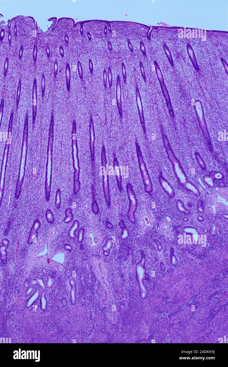 Uterine lining. Light micrograph of a section through human uterine ...