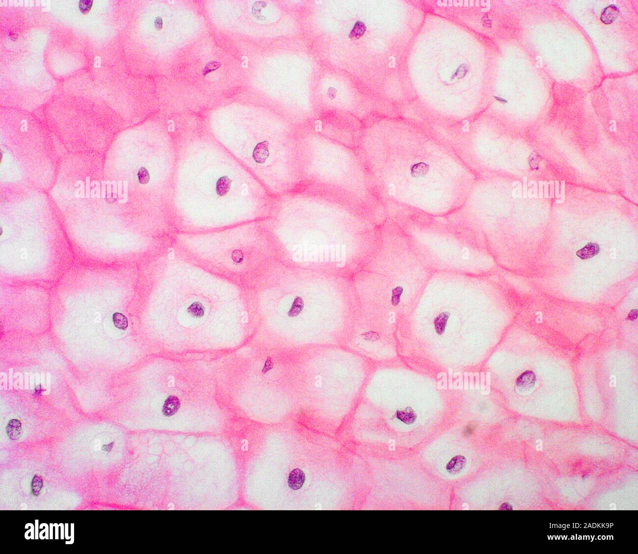 Cervical cells. Squamous epithelial cells from a human cervix ...