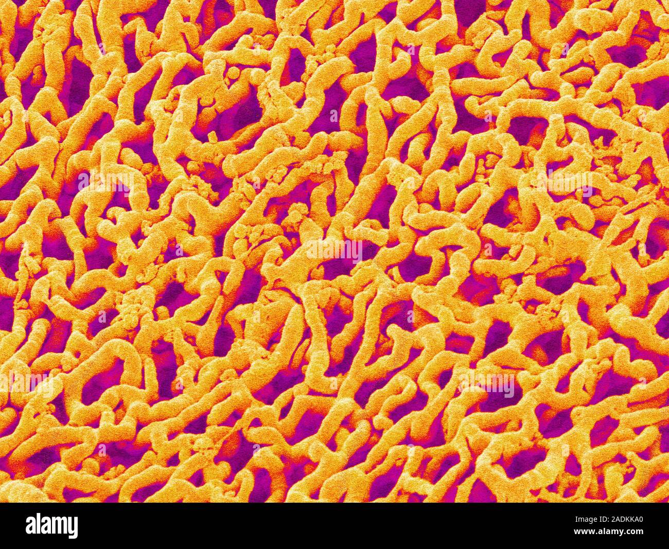 Fallopian tube blood vessels. Coloured scanning electron micrograph ...