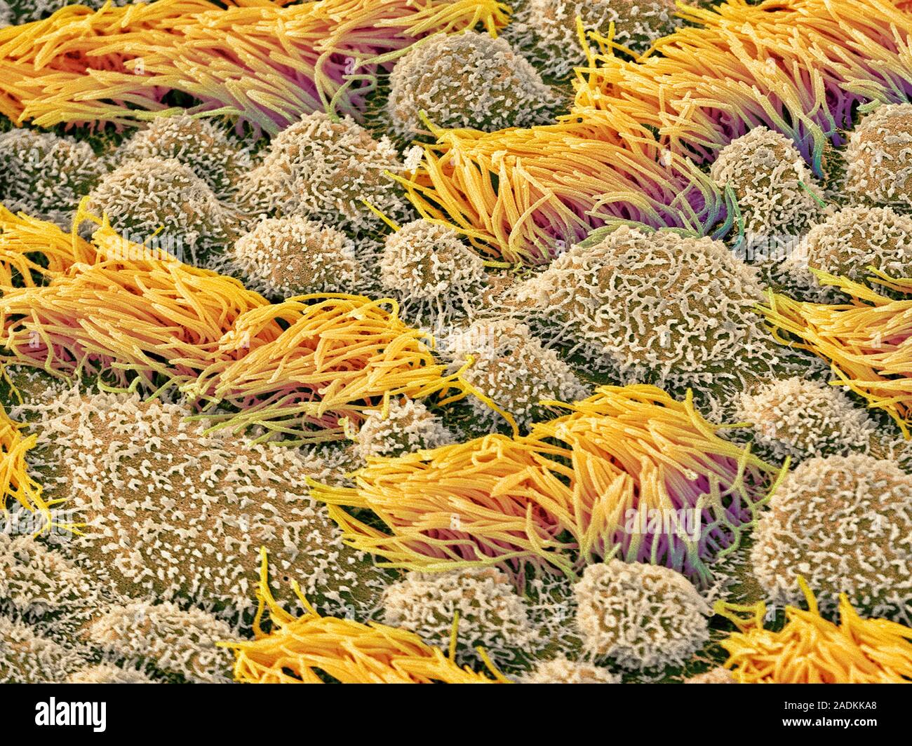Fallopian tube. Coloured scanning electron micrograph (SEM) of the ...