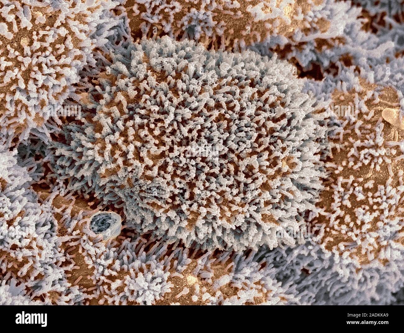 Cervical cells. Coloured scanning electron micrograph (SEM) of cervical ...