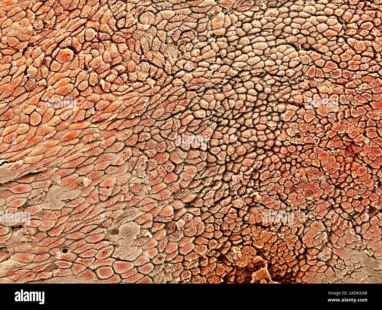 Cervical lining. Coloured scanning electron micrograph (SEM) of a fold ...