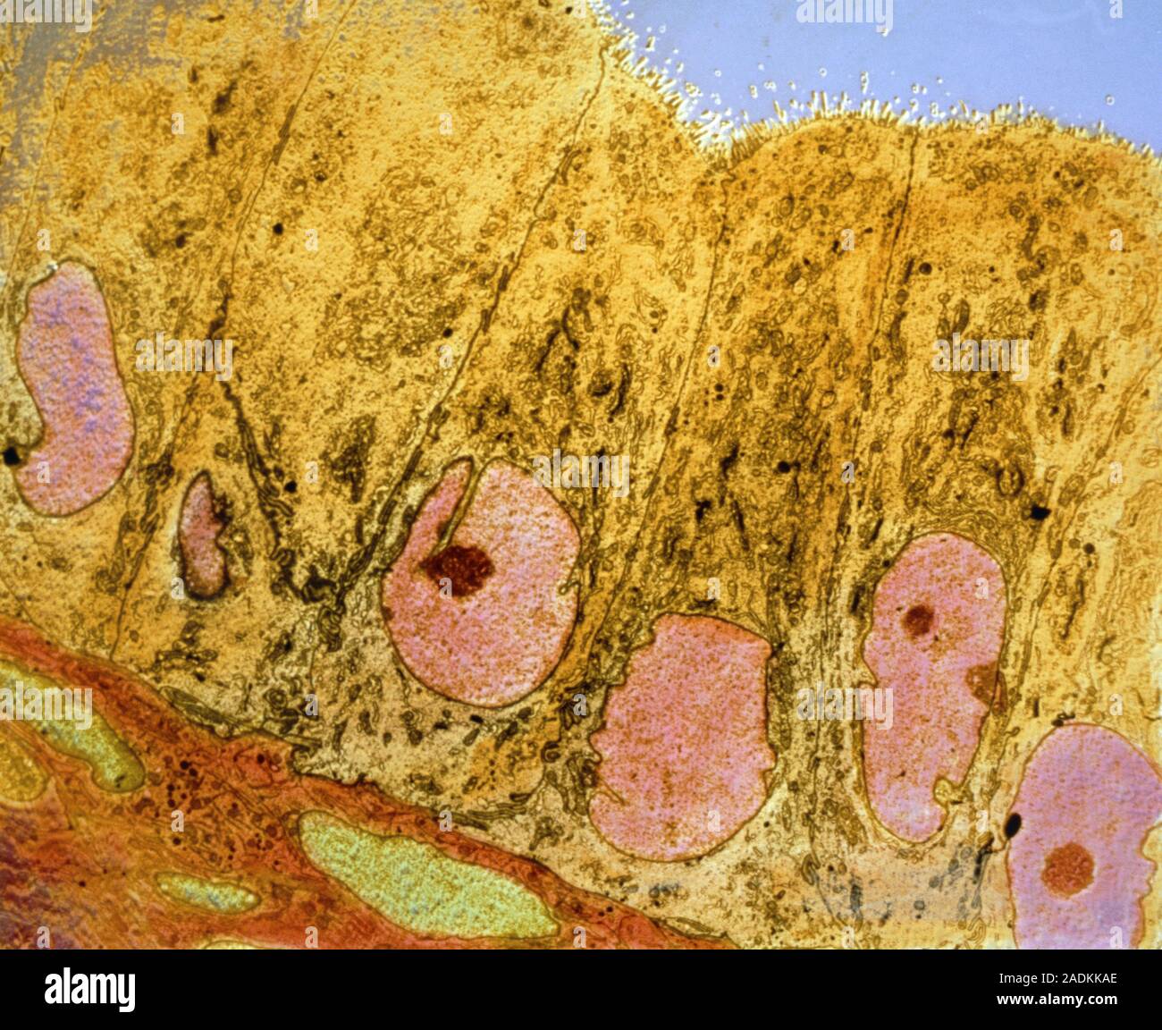 Uterus cells. Coloured transmission electron micrograph (TEM) of ...