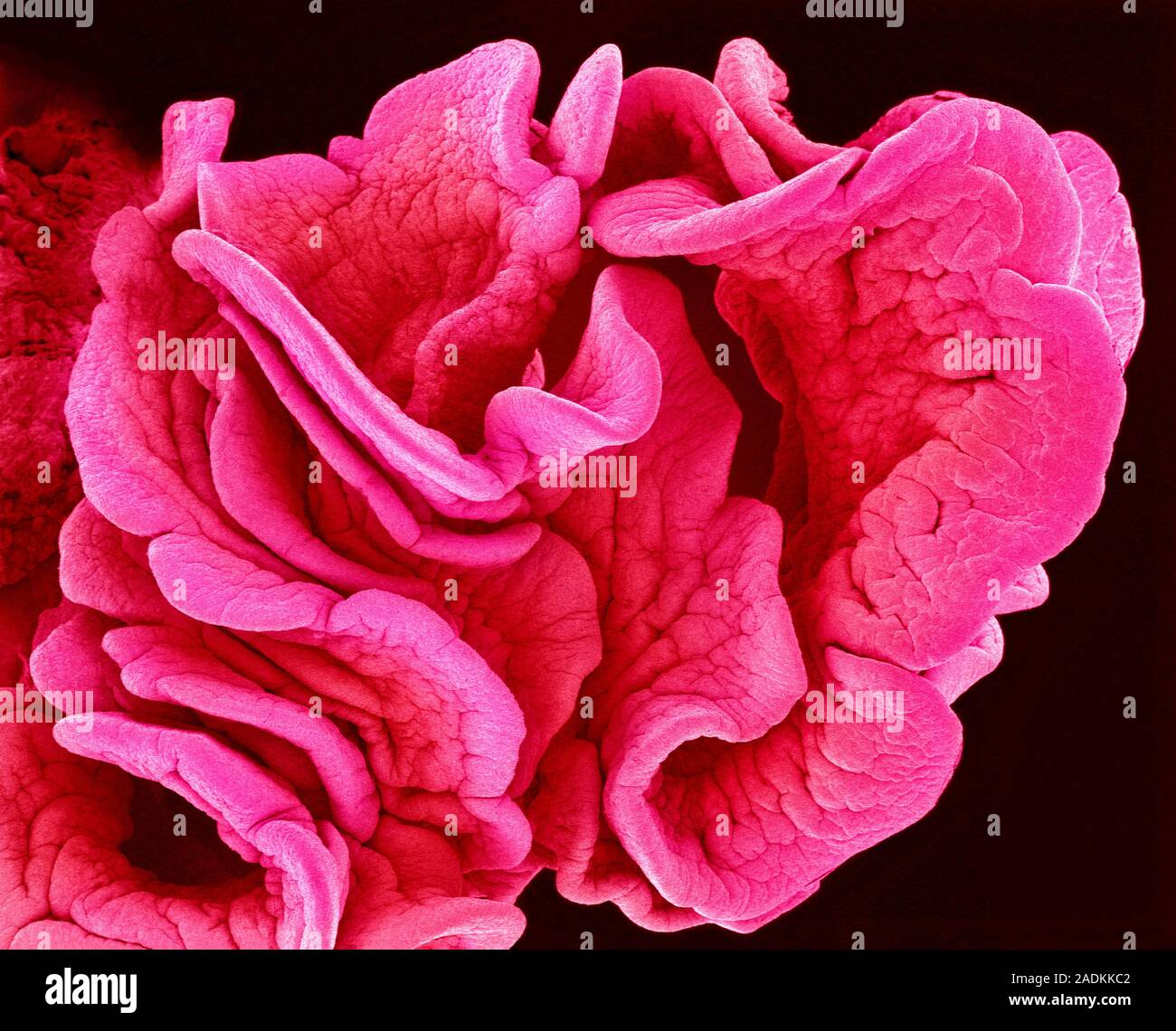 Fimbriae of a Fallopian tube, coloured scanning electron micrograph ...