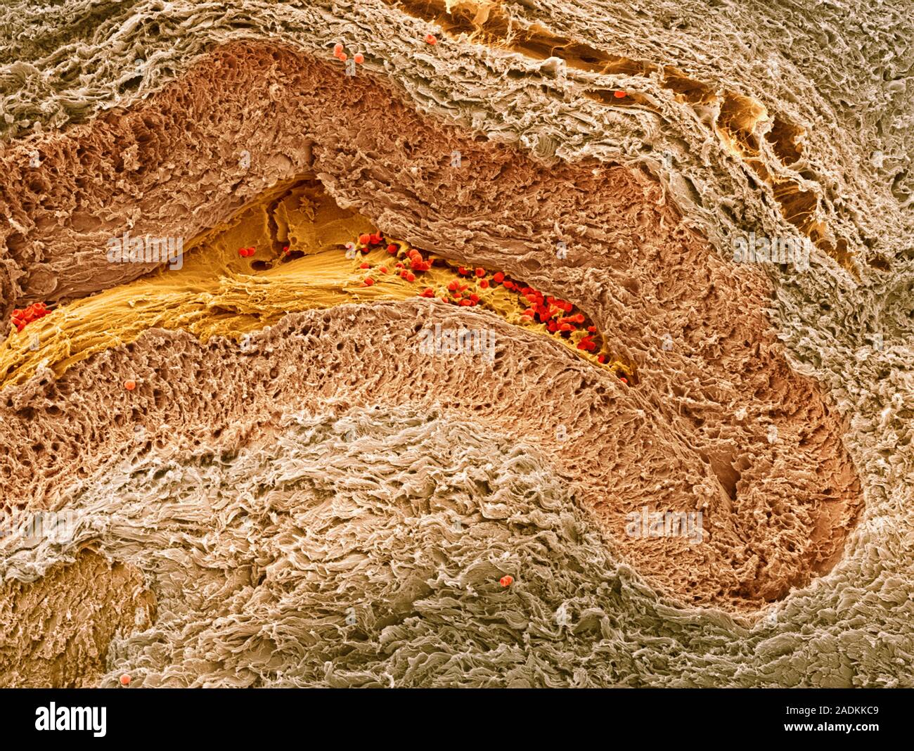 Collapsed ovarian follicle. Coloured scanning electron micrograph (SEM ...