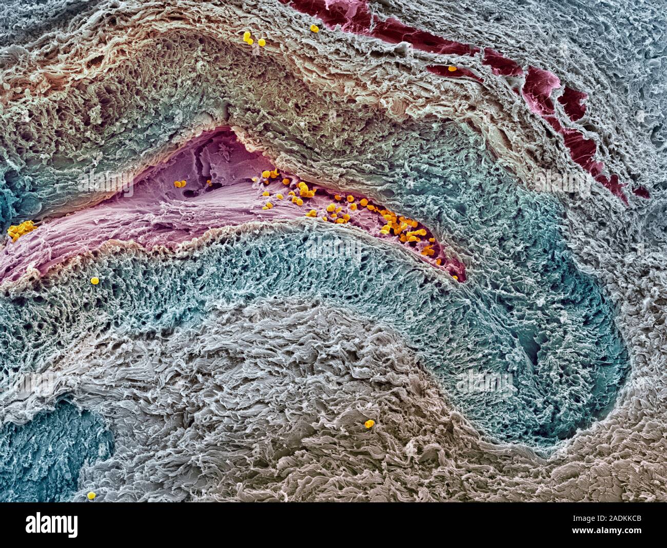 Collapsed ovarian follicle. Coloured scanning electron micrograph (SEM ...