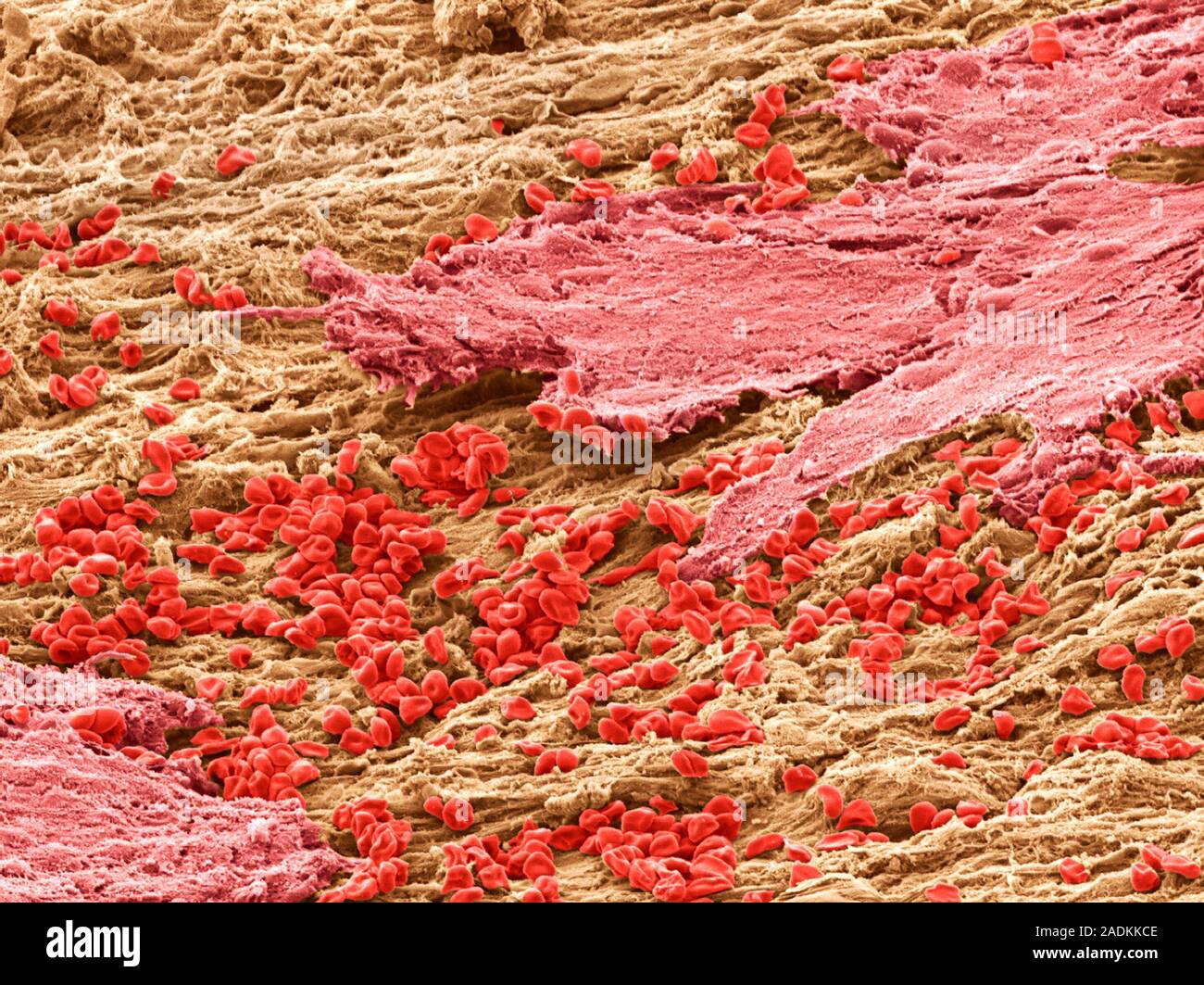 Uterus during menstruation. Coloured scanning electron micrograph (SEM ...