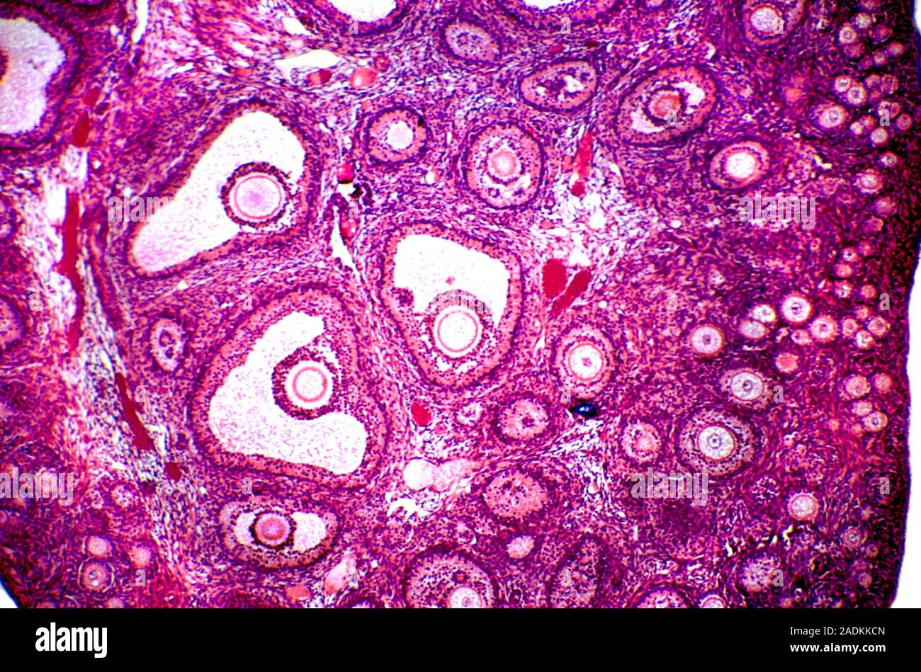 Developing follicles in a human ovary, light micrograph. Three ...