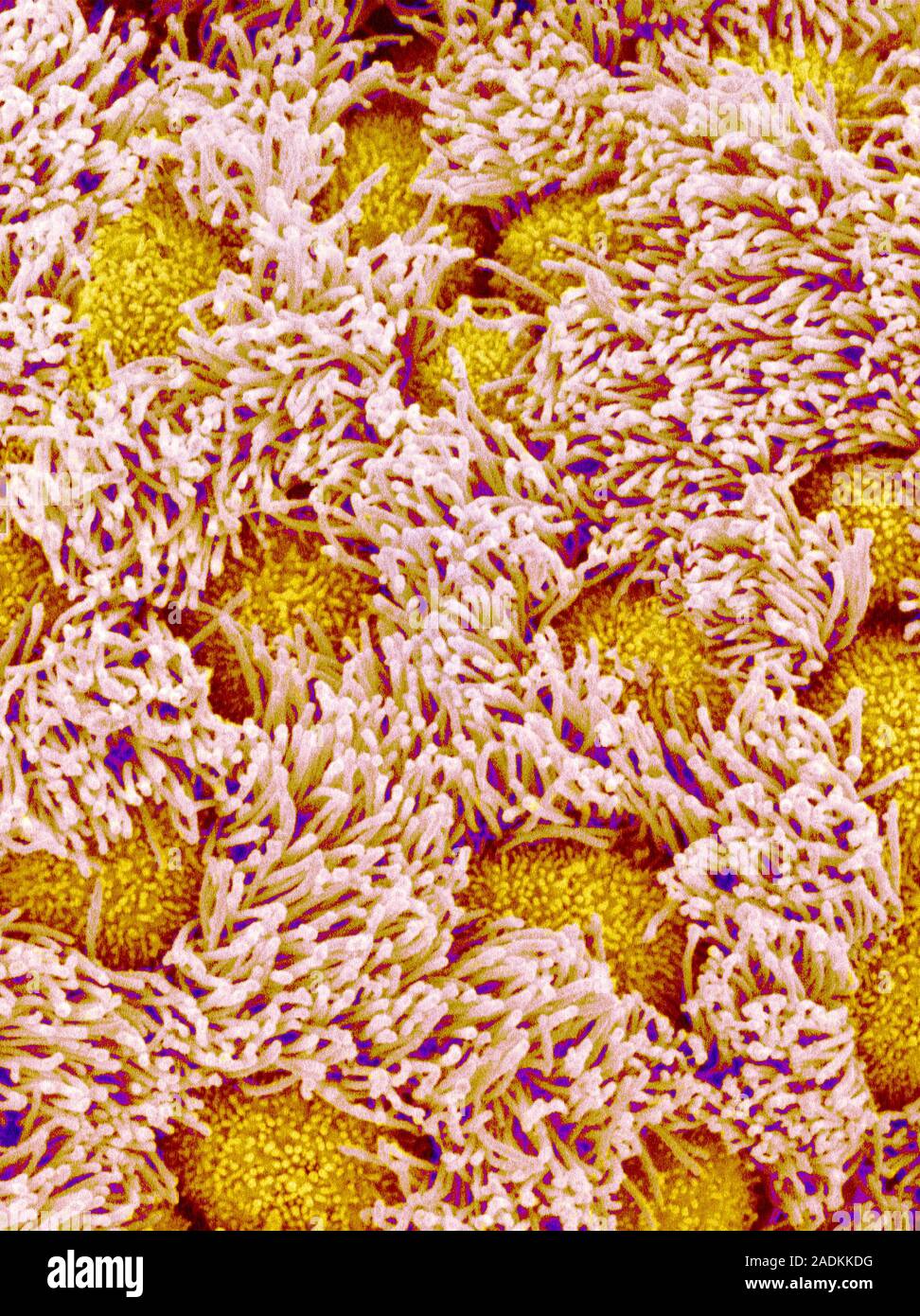 Fallopian tube. Coloured scanning electron micrograph (SEM) of the ...