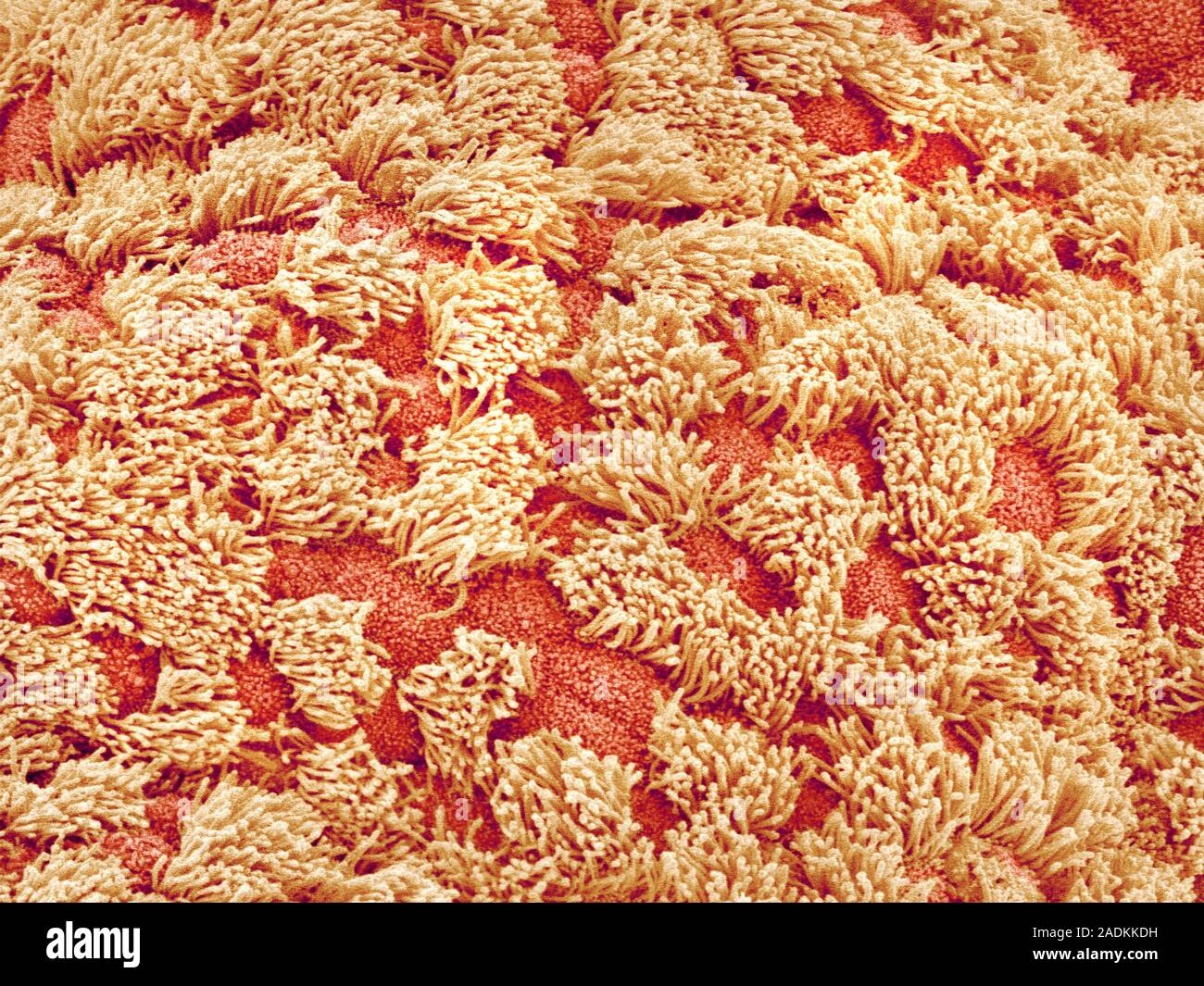 Fallopian tube. Coloured scanning electron micrograph (SEM) of the ...